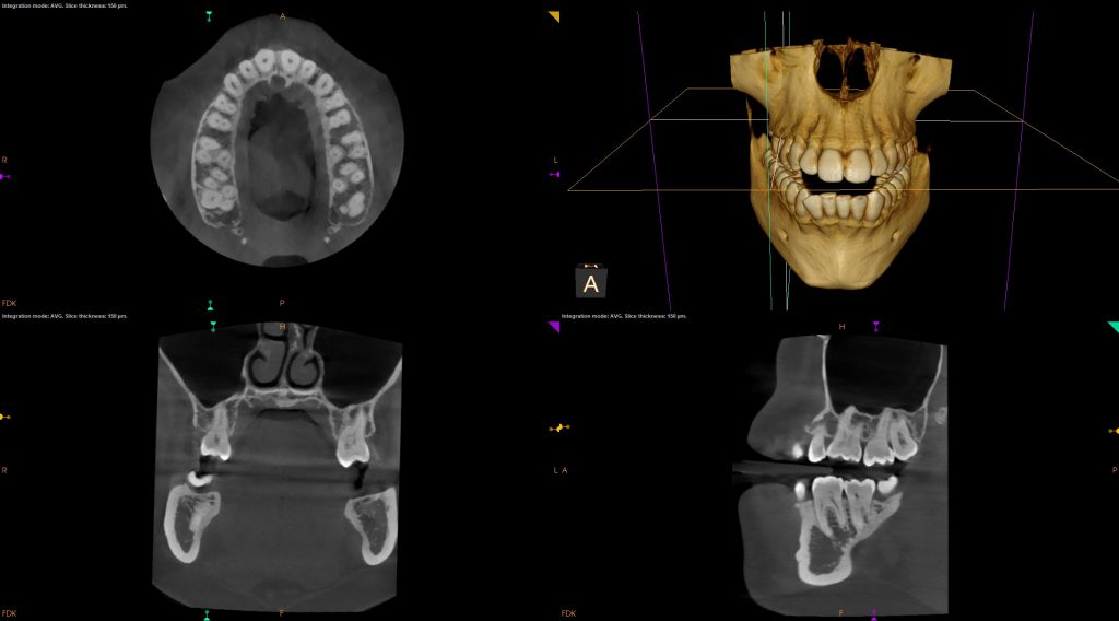 Our Technology - Modern Endodontics PA